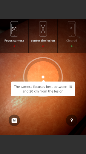 Aspiring Dermatology App Under The Microscope: The SkinVision Review ...